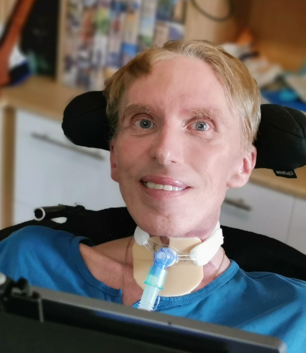 British scientist known as “world’s first cyborg” dies aged 64 « Euro ...