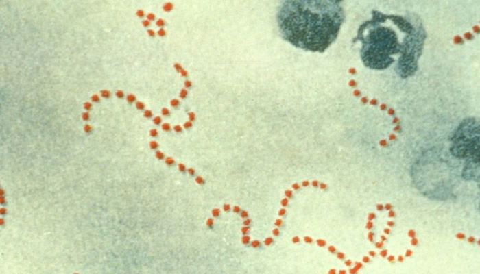 12-year-old UK secondary school pupil to die from Strep A bug