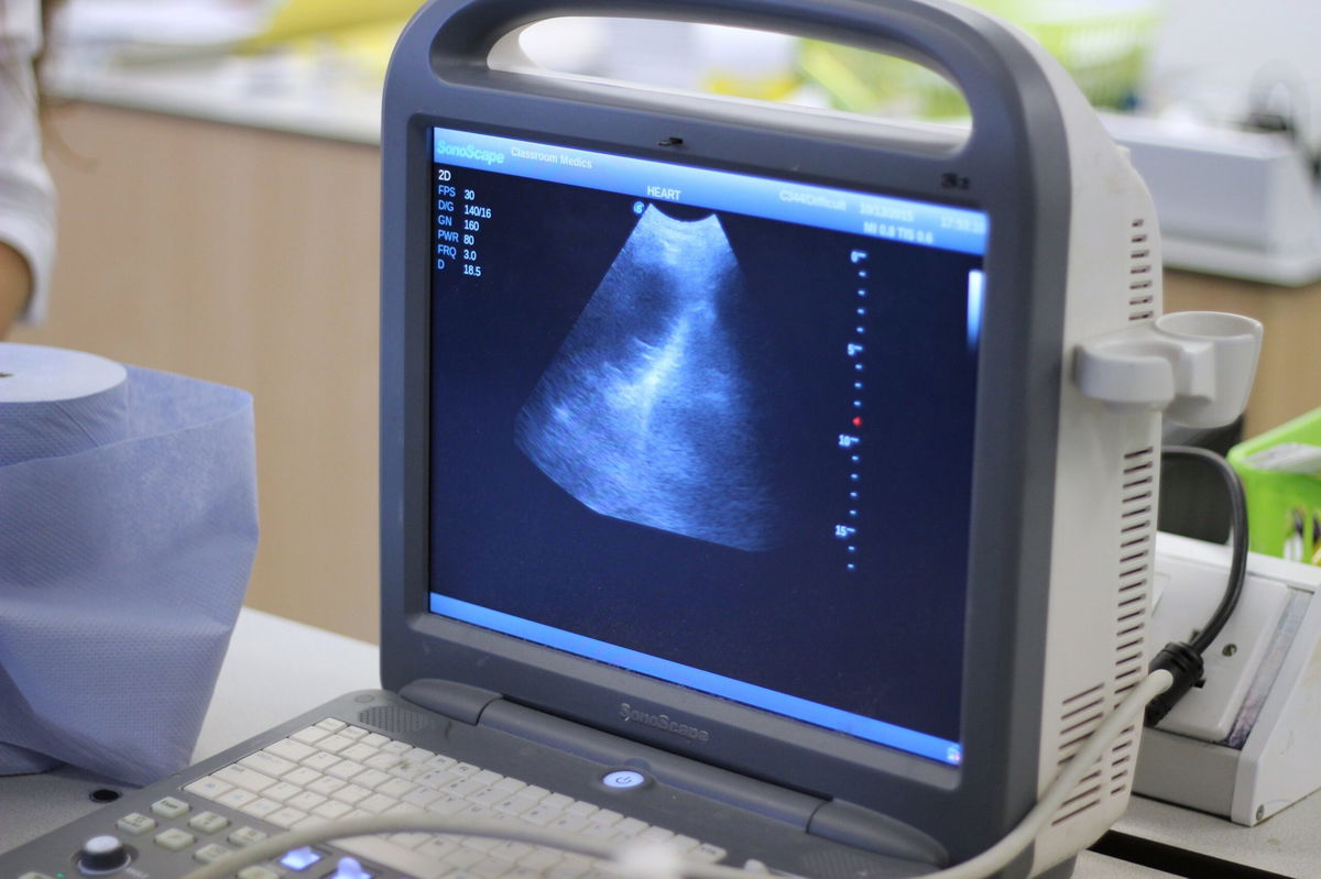 New ultrasound machine for outpatient consultations « Euro Weekly News